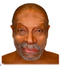 Approach to Stroke - PsychDB